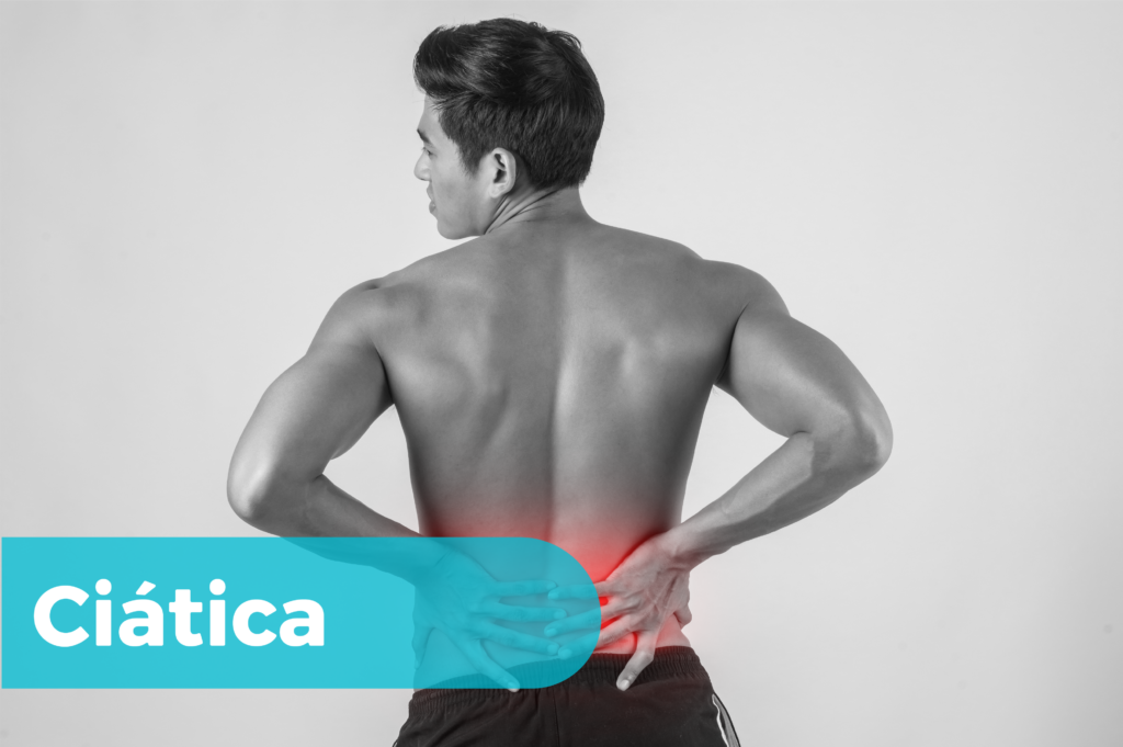 Ciática: causas, síntomas y tratamiento - Doctorisy