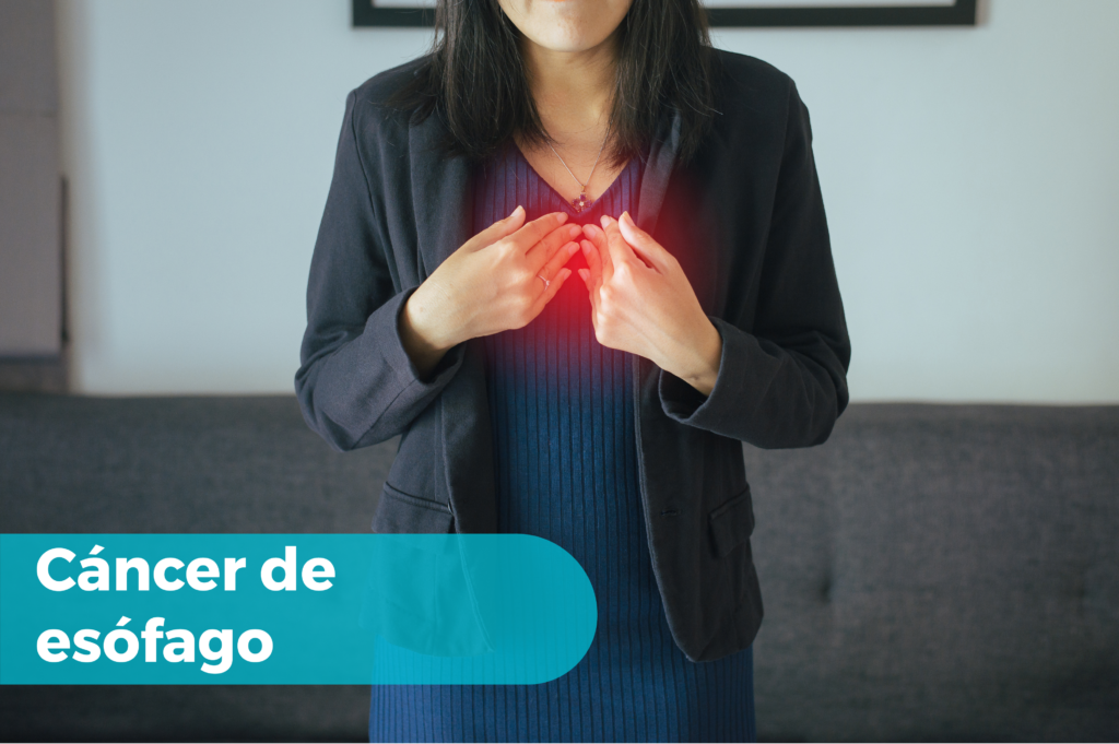 Cáncer de Esófago: causas, síntomas y tratamiento - Doctorisy