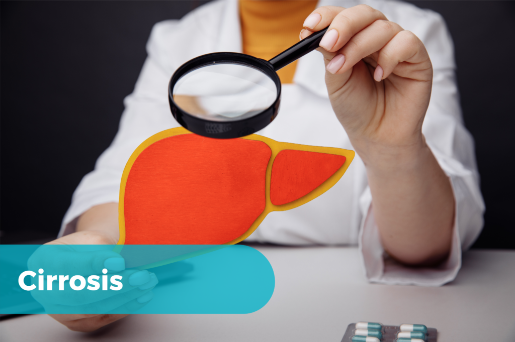 Cirrosis: causas, síntomas y tratamiento - Doctorisy