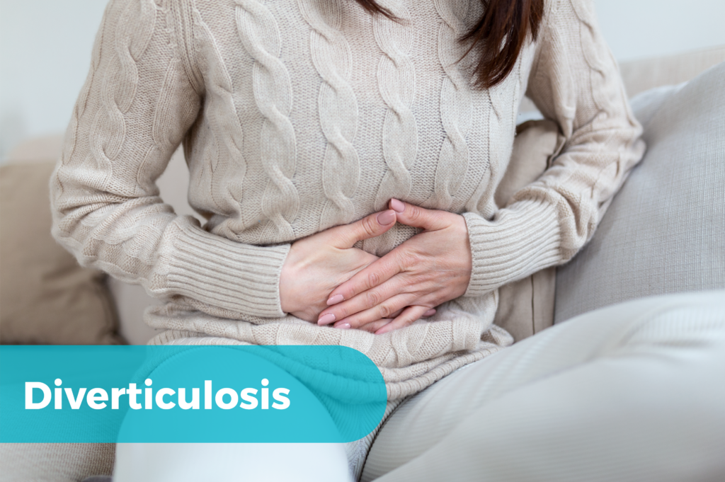 Diverticulosis Causas Síntomas Y Tratamiento Doctorisy